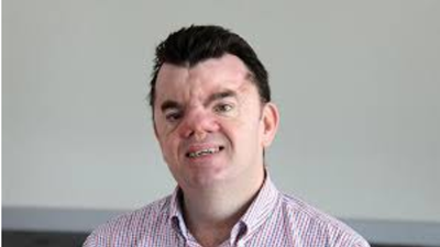 Robert Hoge | MY HERO